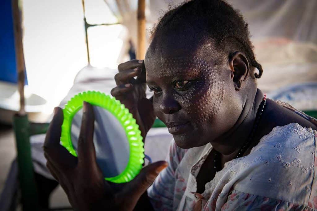 Scarification and the tradition of body branding | ancient body ...